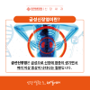 부종과 소변에 이상이 있다면 급성 신장염을 의심해 보세요 창원신장창원붓기창원소변이상창원신장염창원혈뇨창원급성신장염증상
